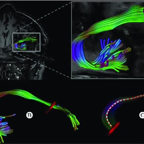 An Example Of Along Tract Analysis A The Uncinate Fasciculus Is First