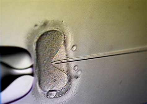 Ny Tells Health Insurers To Speed Up Fertility Coverage For Same Sex Couples
