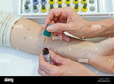 Allergy Testing Application Of Different Allergens Onto The Skin Stock Photo Alamy