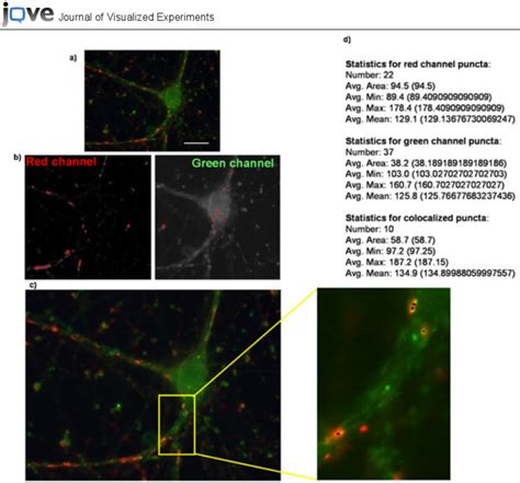 Quantification Of Synapse Number Using Puncta Analyzer Shown Here Is
