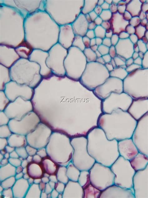 Water Lily Nymphaea Stem Under The Microscope Iphone Case For Sale By Zosimus Redbubble