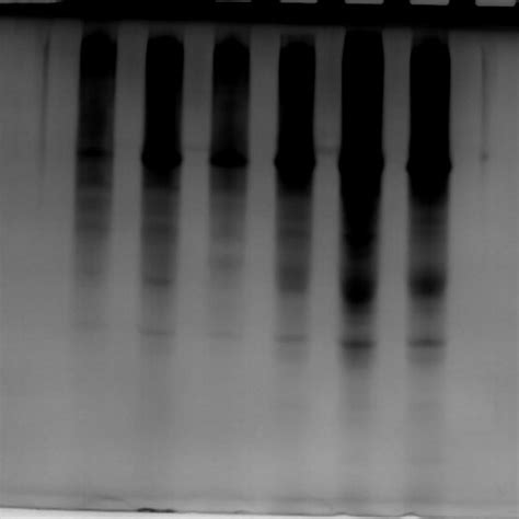 Plasmid Dna Isolation 0 8 Electrophoresis Gel Image Dna Marker Well Download Scientific