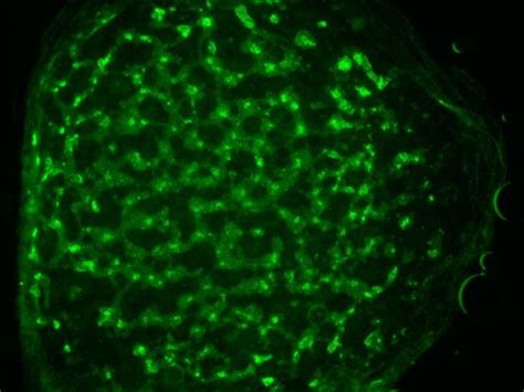 Understanding Sex Development National Stem Cell Foundation Of Australia