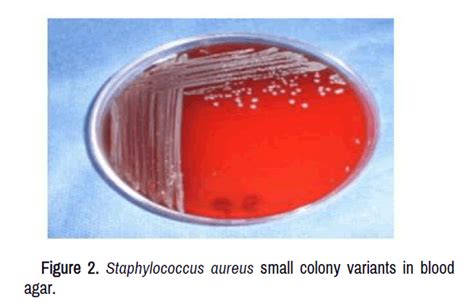 Clinical Infectious Colony