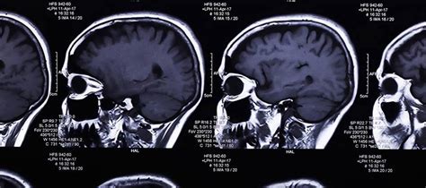 MRI Registry Review Tips To Prepare You For The Exams