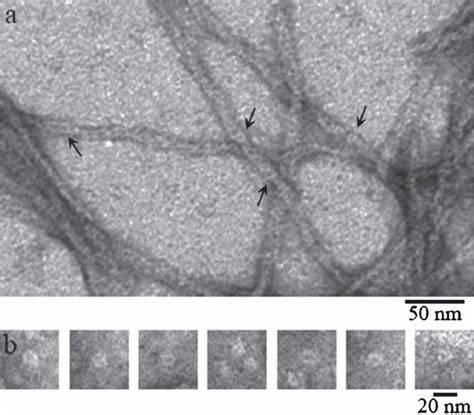 Electron Micrographs Of Recombinant A 40 Incubated At 25 50 Mm Tris