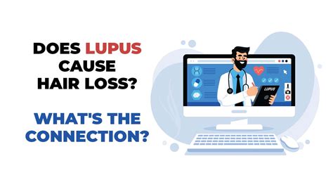 Does Lupus Cause Hair Loss Whats The Connection Theradome
