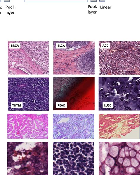Fine Tuning And Training Of Densenet For Histopathology Image