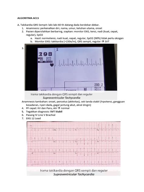 Algoritma Acls Pdf