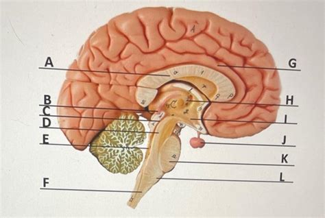 Solved Label the following structures of the brain. | Chegg.com