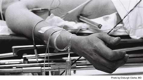 Guidelines On Administering Sedation To Patients Unnecessarily Restrictive For ED Physicians