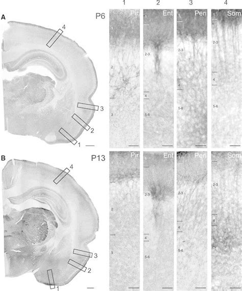 Developmental Expression Of Kcc2 In The Paleo And Neocortex At P6 And