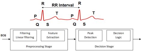 Structure Of The Ecg Qrs Detectors Download Scientific Diagram