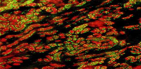 Hepatocyte Nuclear Factor 1 A Transcription Factor At The C Journal Of The American
