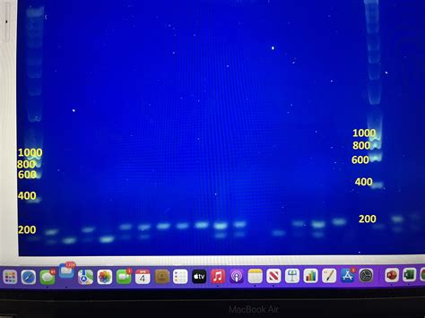 Solved A Gel Model Of Tas Gene Rflp And Pcr 22