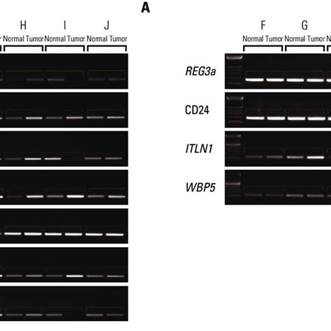 Reverse Transcriptase Polymerase Chain Reaction Was Performed For Download Scientific Diagram