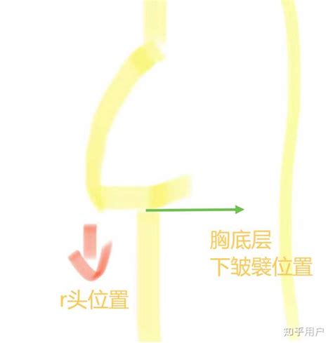 乳房下垂都是怎么看出的，分程度？ 知乎