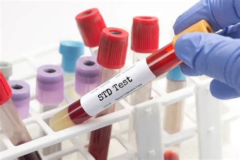 Std Testing For Plano Tx Ob Gyn North Dallas Obgyns