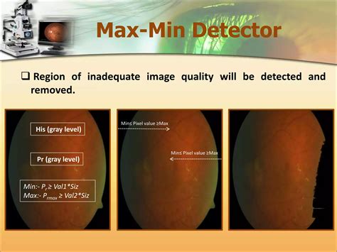 Automatic Detection Of Diabetic Maculopathy From Fundus Images Using Image Analysis Techniques Ppt