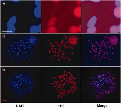 Punctate Fine Granular Staining Of Chromosomes And Dna Fibers With 1h6 Download Scientific