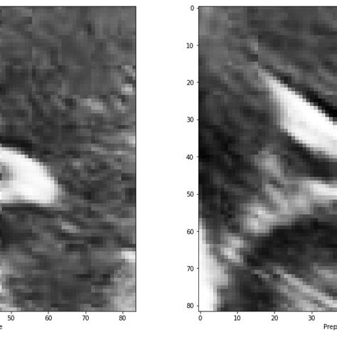 Preprocessing Of An Image With The Objective Of Scaling The Values