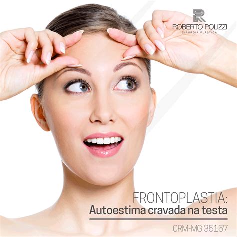 Frontoplastia Autoestima Cravada Na Testa Dr Roberto Polizzi