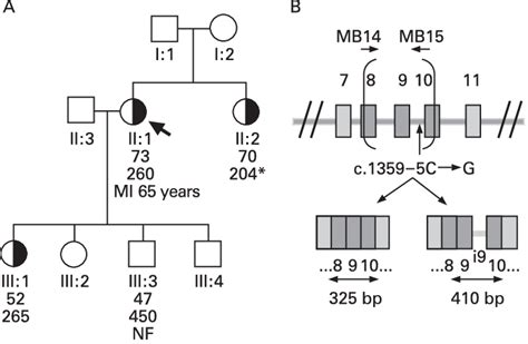 Effect Of The C 135925crg Mutation On Ldlr Mrna A Pedigree Of Index