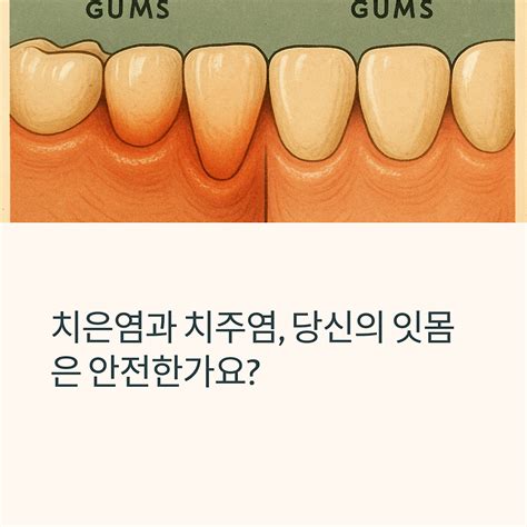 치은염과 치주염의 결정적 차이 건강한 잇몸을 위한 모든 것