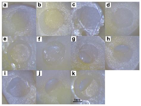 Coatings Free Full Text Shear Bond Strength And Microleakage Of Pit And Fissure Sealants