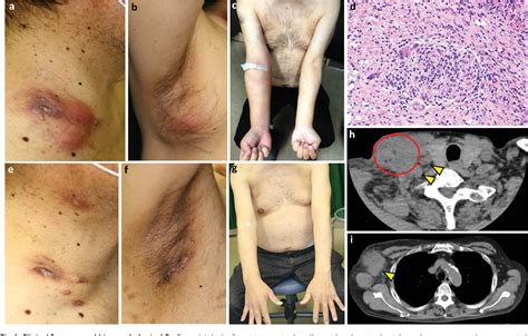 Figure 1 From Multiple Diagnostic Examinations Are Effective For The
