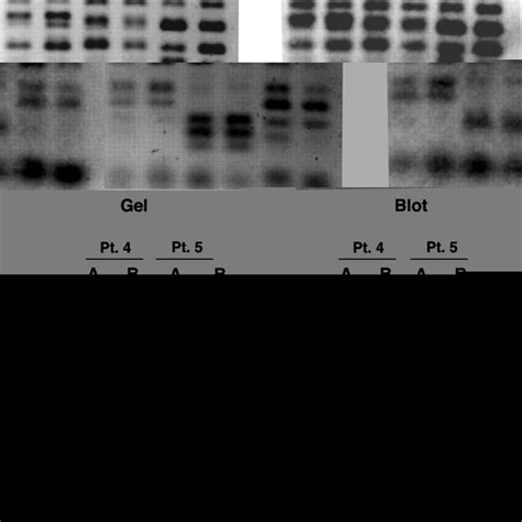Similarity Analysis Of Restriction Fragment Length Polymorphism Rflp Download Scientific