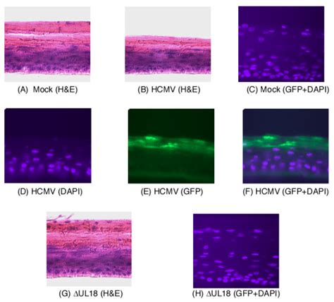 Hematoxylineosin A B And G And Fluorescent Staining C F H Of