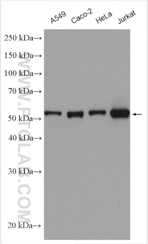 Prpf31 Polyclonal Antibody 27750 1 Ap150ul
