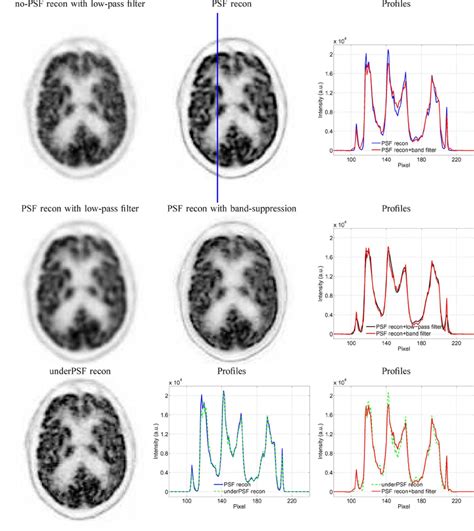 Psf Reconstruction And Mitigation Results For One Transaxial Slice Of