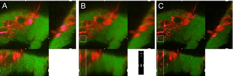 Proof Of Principle Of Psf Extraction And Deconvolution A Confocal