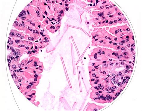 Proliferative And Nonproliferative Lesions Of The Rat And Mouse