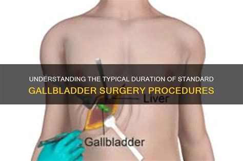 Understanding The Typical Duration Of Standard Gallbladder Surgery