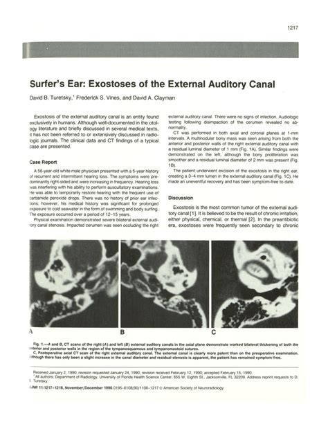 Pdf Surfers Ear Exostoses Of The External Auditory Canal
