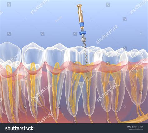 Tooth Pulp Cavity Slide