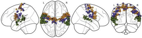 Linear And Non Linear Methods To Discriminate Cortical Parcels Based On