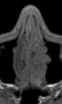 Object Extraction First Type Download Scientific Diagram