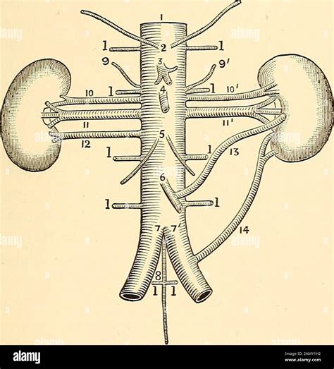 Psoas Zeichen Und Obturatorzeichen