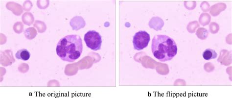 An Example Of Data Augmentation Using An Original Image Download