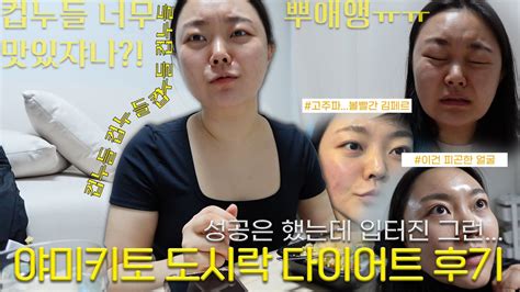 N잡러 브이로그 야미키토 도시락 다이어트 성공 후기라고 적고 입터진 후기라 쓴다 고주파 받음 Youtube