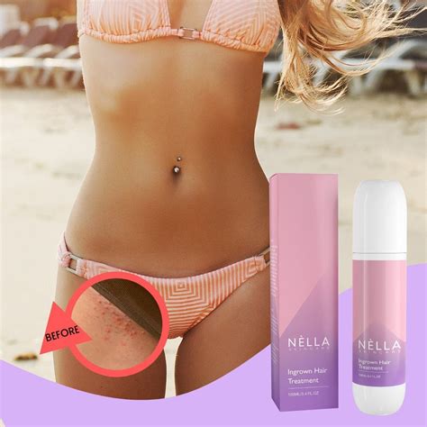 Ingrown Hair Removal Oil For Bikini Face Legs Soothing Post Waxing