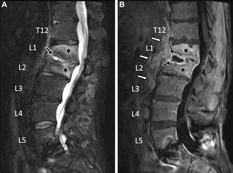Neuroimaging Patterns Of Recreational Drug Use In The Emergency