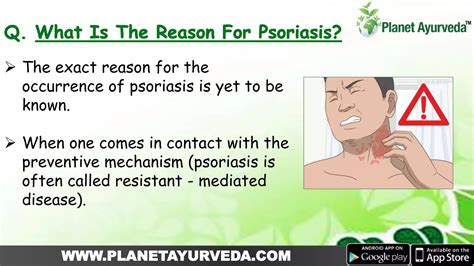 Psoriasis Frequently Asked Questions And Answers Pptx