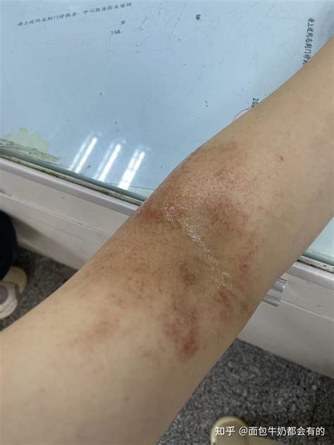 杜碧丝脱毛喷雾 知乎
