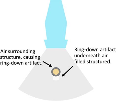 Ring Down Another Specific Reverberation Artifact Air Surrounding Or