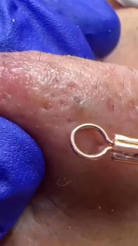Pin On Skin Care